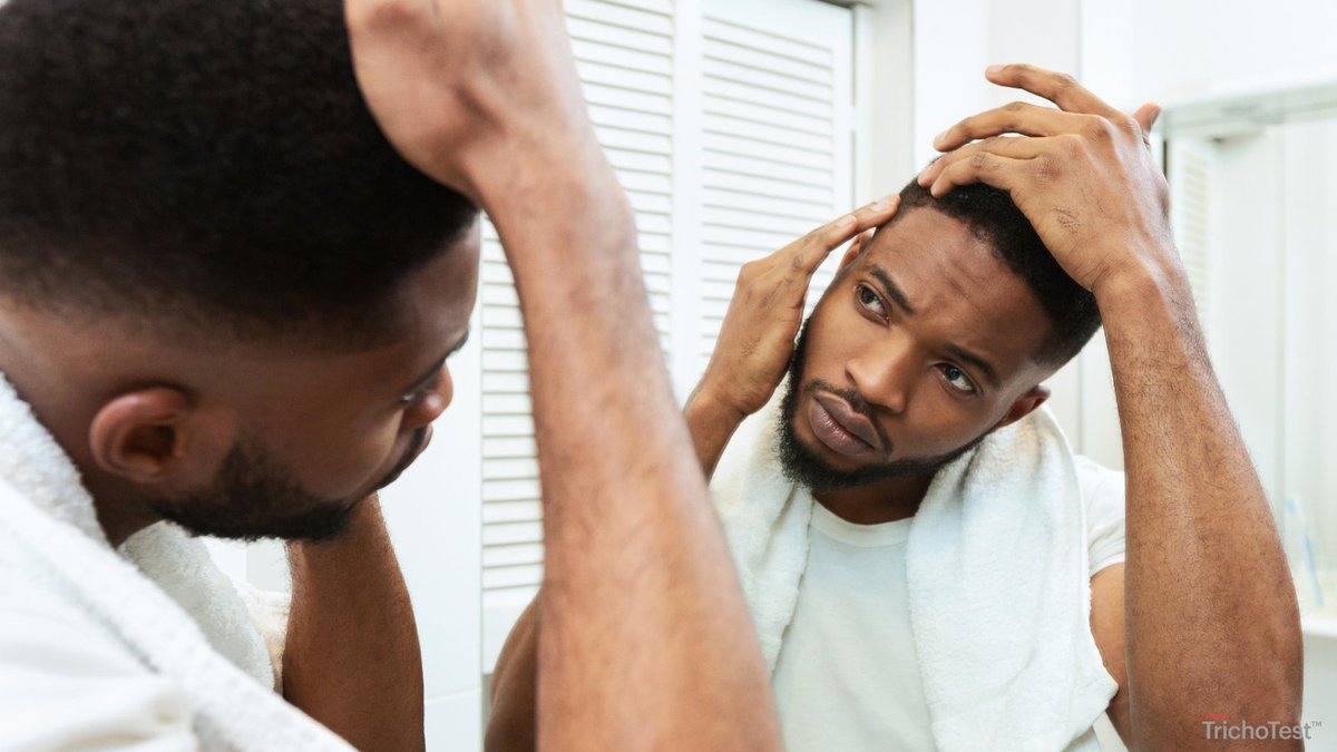Male Pattern Baldness: Understanding the Most Common Form of Hair Loss ...